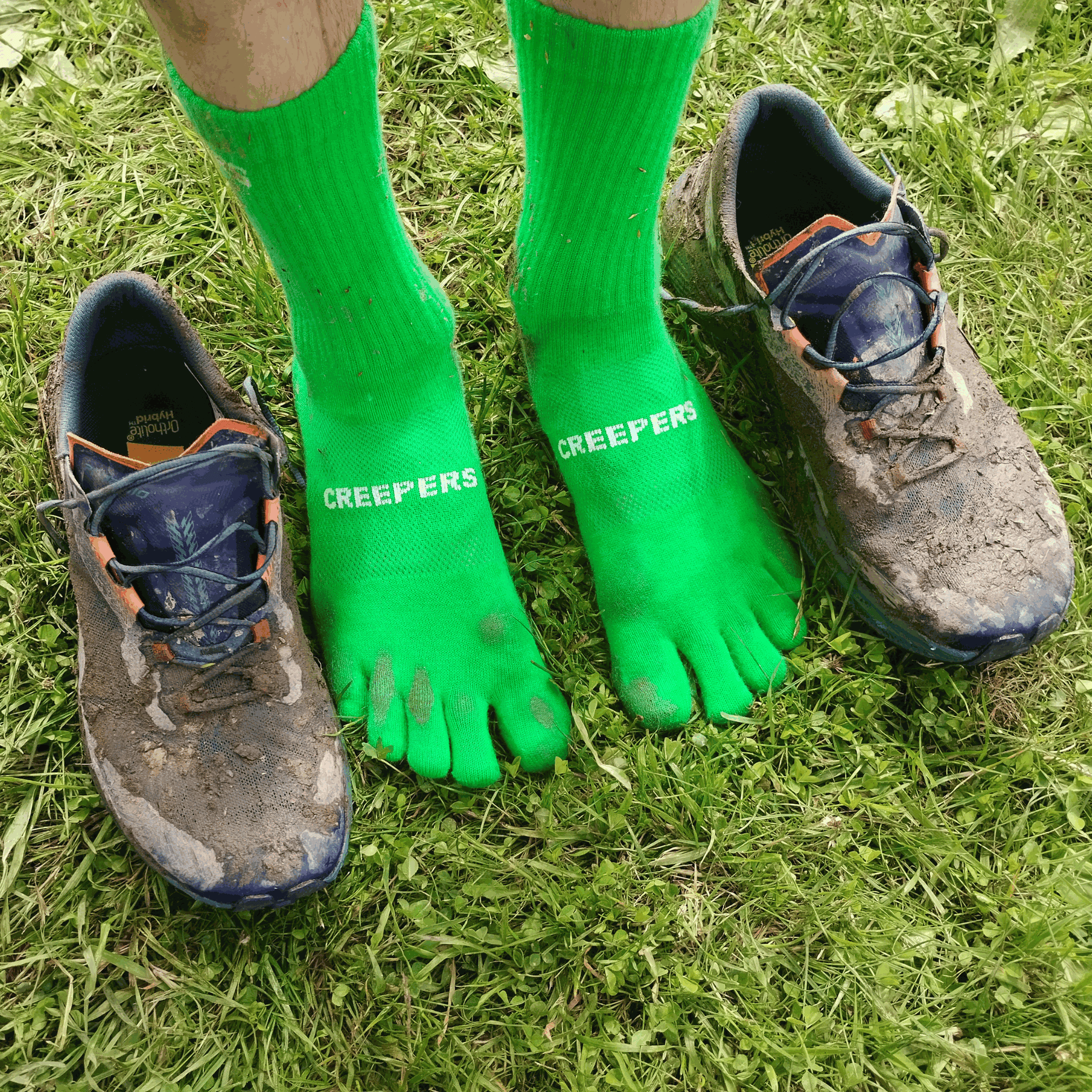 The Rare Ones | Creepers Colored Toe Socks | Creepers Socks